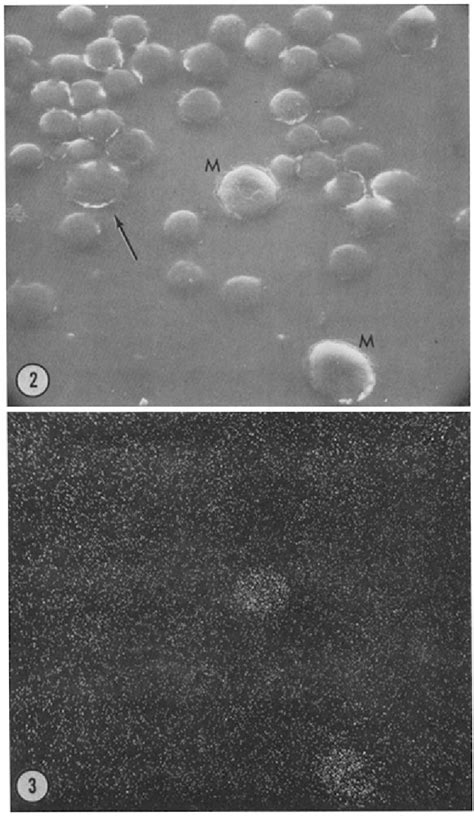 Figure 2 From Identification Of Mast Cells In The Scanning Electron