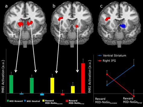Ventral Striatum Fmri