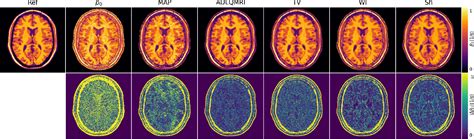 Figure 1 From Quantitative Mr Image Reconstruction Using Parameter