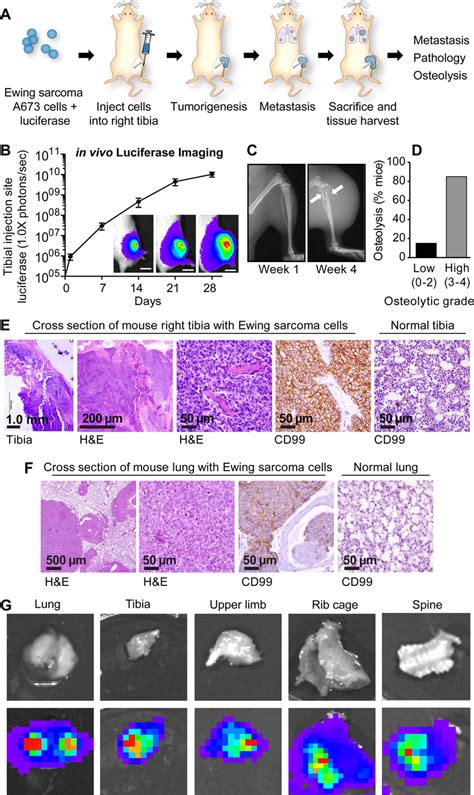 Intratibial Orthotopic Mouse Model For Ewing Sarcoma Recapitulates Download Scientific Diagram