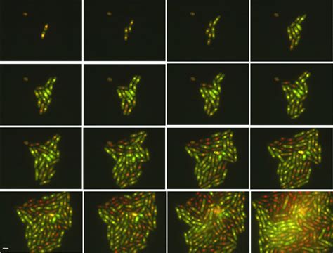 Fission Yeast Cells Dividing Under A Fluorescence Microscope Download Scientific Diagram