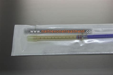 Naltrexone Implant Naltrexone Teatment
