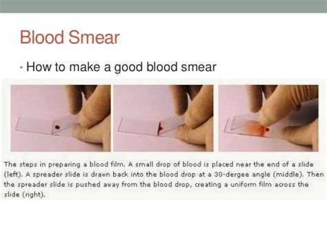 Hematology Basics Pt 1 