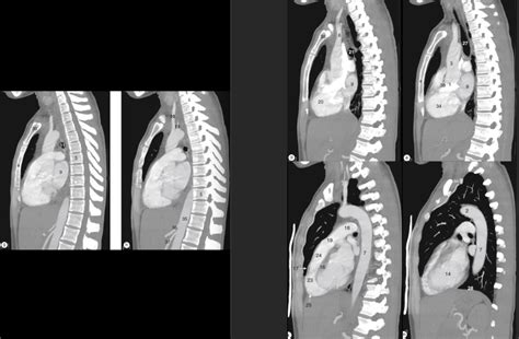 Chest Sagittal Images Diagram Quizlet