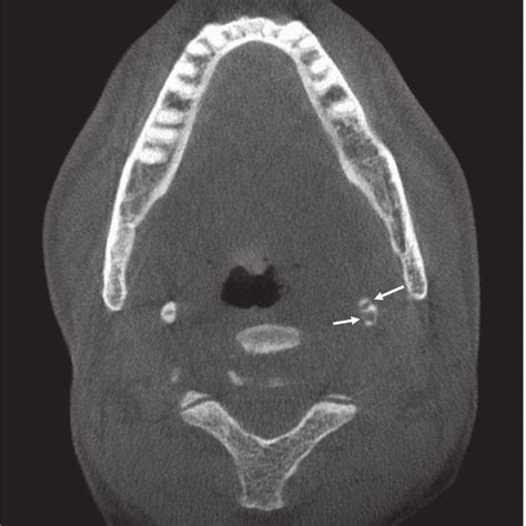 Three Dimensional Reconstruction Cone Beam Computed Tomography Image Download Scientific