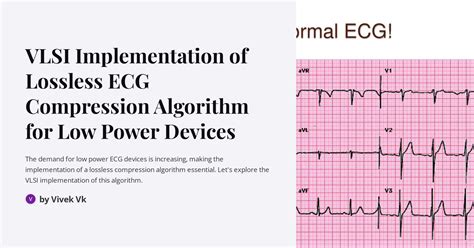 Vlsi Implementation Of Lossless Ecg Compression Algorithm For Low Power