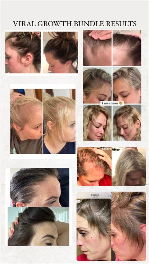 Pin By Lauren Koczi On Monat Monat Hair Hair Transformation Monat