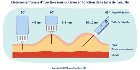 guide pratique des injections sous cutanées réussis ton ifsi