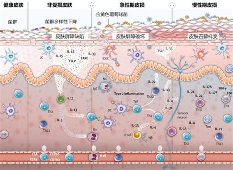 一探究竟：ad 急性期的本终始末 丁香园