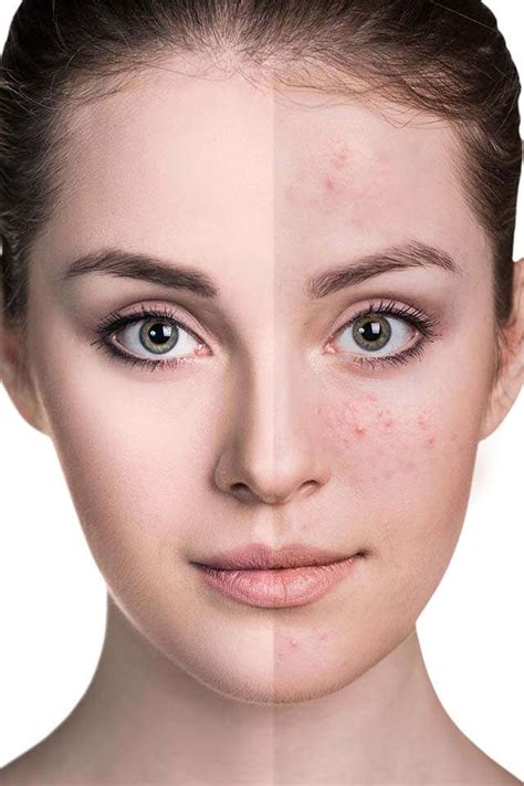 How To Get Glowing Skin With Body Polishing