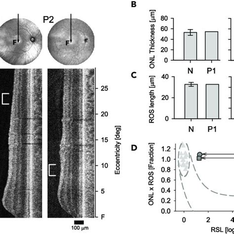 Retinal Structure Before Treatment And Structure Function Relationship
