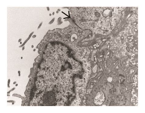 Histological Analysis Of The Tissue Are Shown By A Hande Staining Of