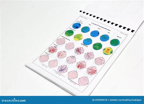 Brain Mapping Done By A Neurologist Doctor With Neuroscience Technique