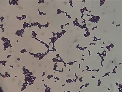 Enterococcus Avium Introduction Morphology Pathogenicity Lab