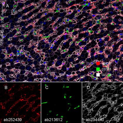 Glucose Transporter Glut2重组抗体 Epr22946 74 Glucose Transporter Glut2抗体