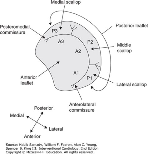 An Overview Of The Mitraclip Procedure Practical Considerations And