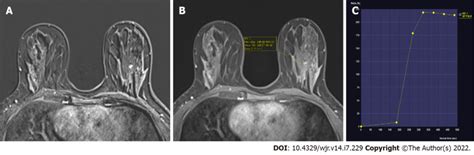 Type Dynamic Curves A Diagnostic Dilemma PMC