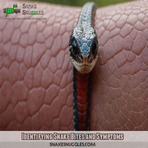 Snake First Aid Essentials Top Kits And Lifesaving Tips For Venomous Bites