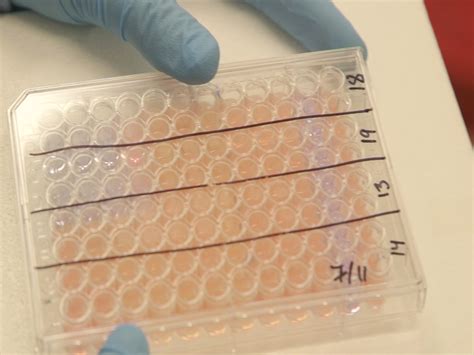 New Ways To Kill Superbugs Scitech Now