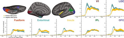Regions Of Interest And Average Stimulus Evoked Responses Top Left