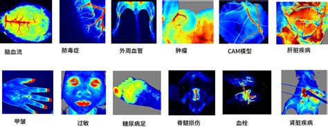 动物实验研究中心激光散斑血流成像系统启用 浙江中医药大学中医药科学院
