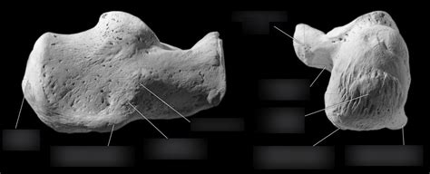 Right Calcaneus 3 Diagram Quizlet