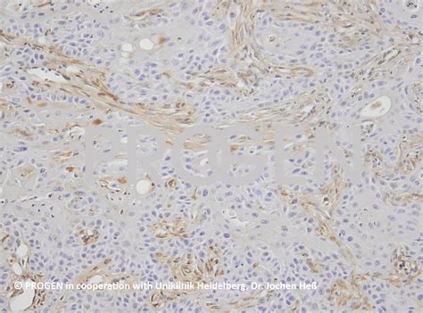 Anti Vimentin Mouse Monoclonal Vim 3b4 Lyophilized Purified 50 µg 61013