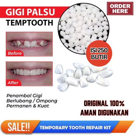 Jual Penambal Gigi Best Seller Lem Gigi Gigi Palsu Penambal Gigi