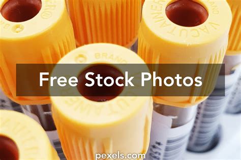 Intramuscular Lipoma Pathology Outlines Photos Download The Best Free