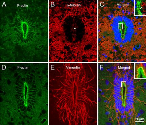 Fluorescence Microscopic Localization Of F Actin A Tubulin And Download Scientific Diagram