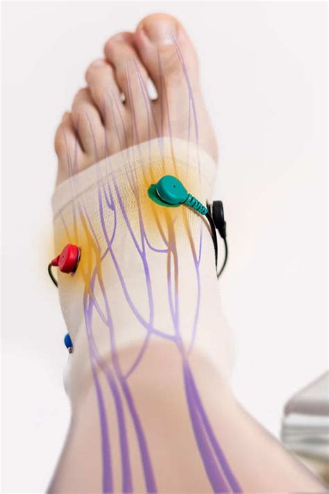 Neuromodulación Nesa Palma Fisionos