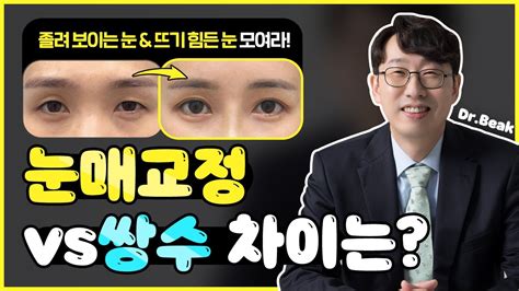 쌍꺼풀수술할 때 눈매교정 필수일까🤷‍♀️ 눈매교정과 쌍수의 차이 절개vs비절개 눈매교정 추천대상까지🙌 Youtube