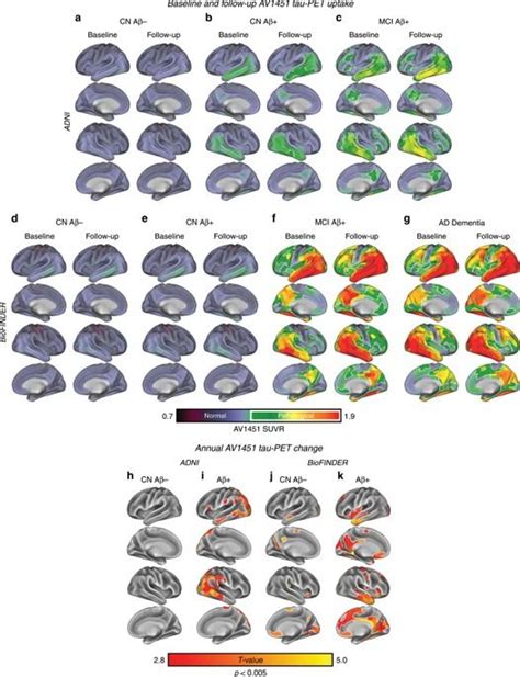 Functional Brain Architecture Is Associated With The Rate Of Tau Accumulation In Alzheimers