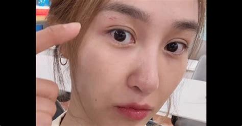 옥주현 일본서 얼굴 부상… 다치고 꿰매 한 달에 한 번씩 치료