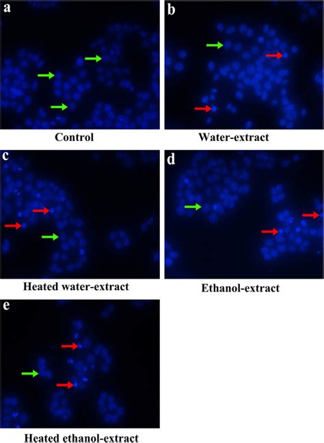 Morphological Features Of HCT 116 Cells Treated With Cell Medium