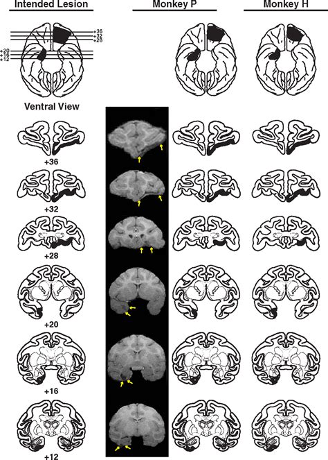 Figure 2 From Interaction Between Orbital Prefrontal And Rhinal Cortex Is Required For Normal