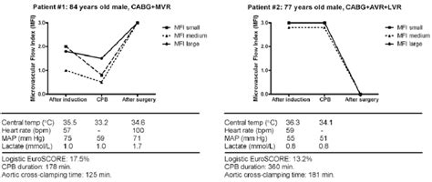 Detailed Perioperative Macrohemodynamic And Microcirculatory Parameters