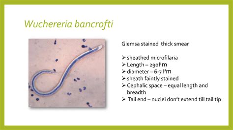 Filariasis Classification And General Features Pptx