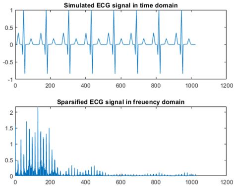 Review On Compressive Sensing Algorithms For Ecg Signal For Iot Based Deep Learning Framework