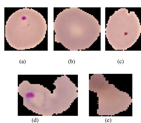 Figure 2 From Cnn Based Deep Learning Approach For Automatic Malaria Parasite Detection