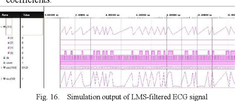 figure 16 from design of efficient adaptive lms filter for noise reduction in ecg semantic scholar