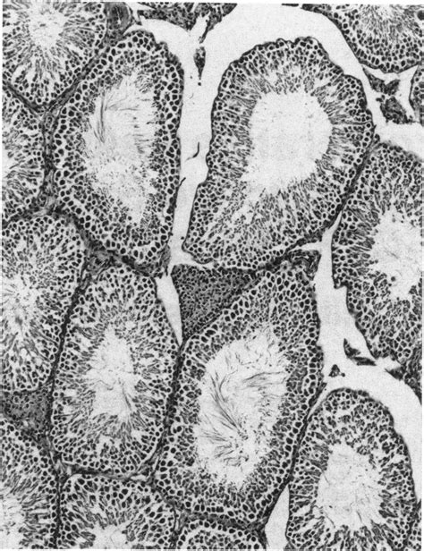 Interstitial Cell Hyperplasia Of The Testis In A F344 Rat Consisting Of