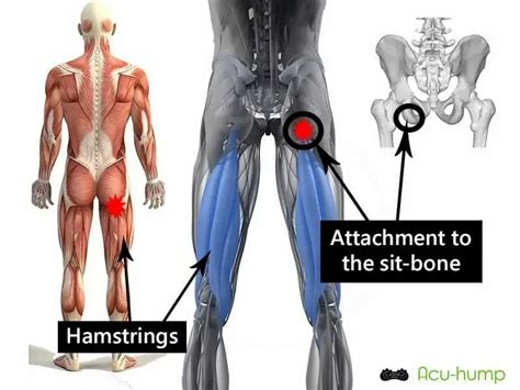 High Hamstring Tendinopathy Vs Piriformis Syndrome Blog