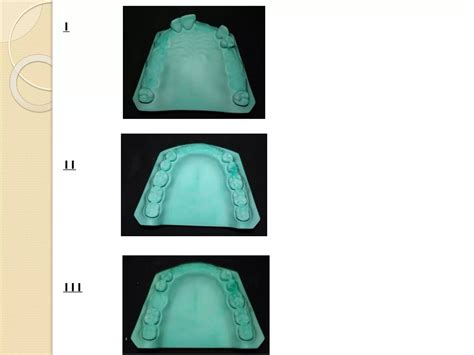 Rpd Classification Ppt Free Download