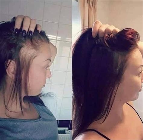 Nejprodávanější ČESNEKOVÝ šampon proti padání vlasů Aukro