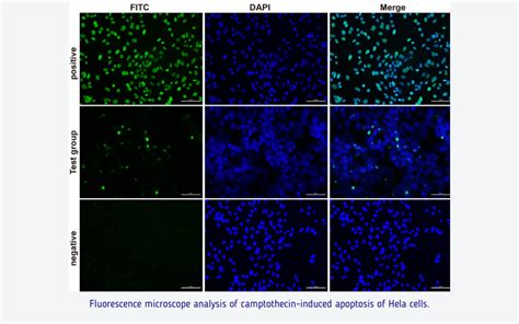 Apoptosis Kit