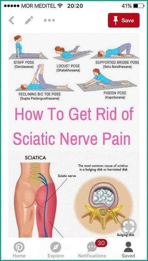 Could It Be Sciatica Upper Cervical Awareness Artofit