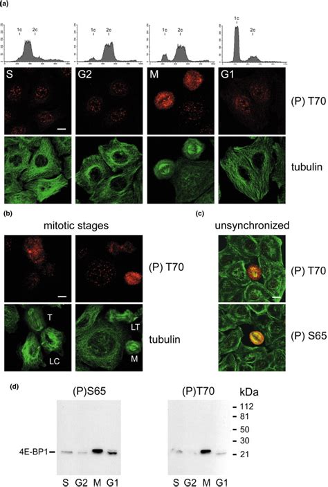Cell Cycle Dependent Phosphorylation Of The Translational Repressor Eif