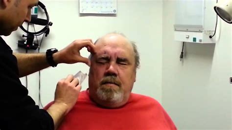 Touching Moment Blind Man Sees For First Time Youtube