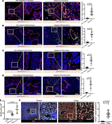 JCI Insight Requisite Endothelial Reactivation And Effective SiRNA
